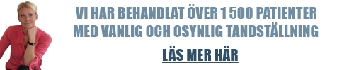 Tandreglering & Tandställningar - Smajla
